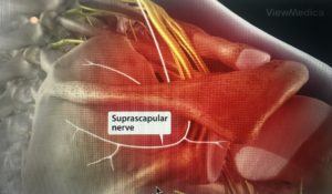 Lesão do nervo supra escapular - Ortopedia Ombro - CIRURGIA DO OMBRO E ...