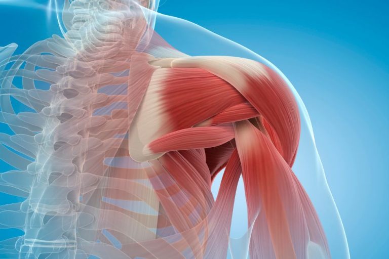 Capsulite adesiva: saiba quais são as causas, fases e como tratar a ...
